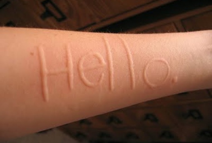 use my skin condition dermographism to write anything you want on it